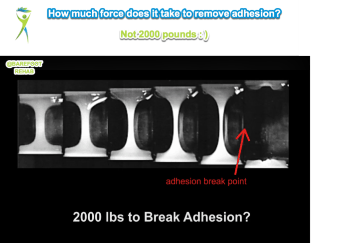 myofascial-release-break-adhesion